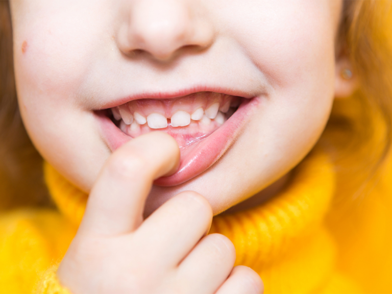 Baby Teeth - Victor Smiles - Victor, NY